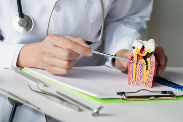 Root Canal Treatment in Burlington CT - Dr. Bethaney Brenner DMD